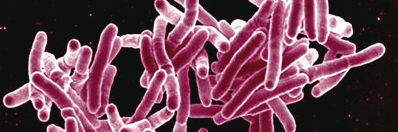 African scientists a step closer to testing for TB in a matter of ...