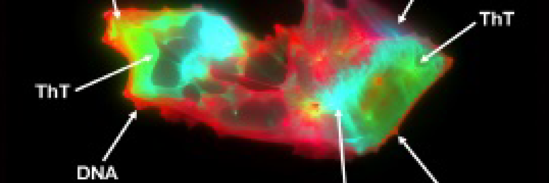 Scientists reveal another piece in Long COVID puzzle | Stellenbosch ...