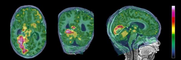 Stellenbosch University leads groundbreaking research project in ...